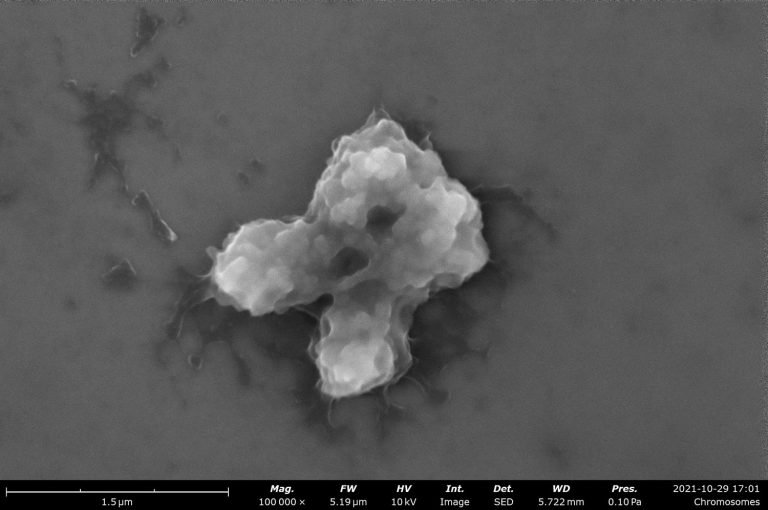 Understanding the Difference between Magnification and Resolution in ...