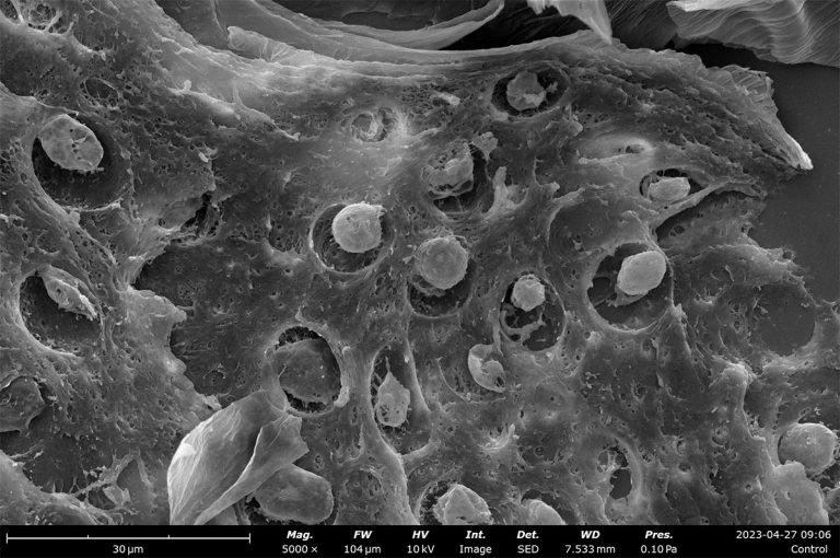 Visualizing Skin Tissue Morphology with Scanning Electron Microscopy ...