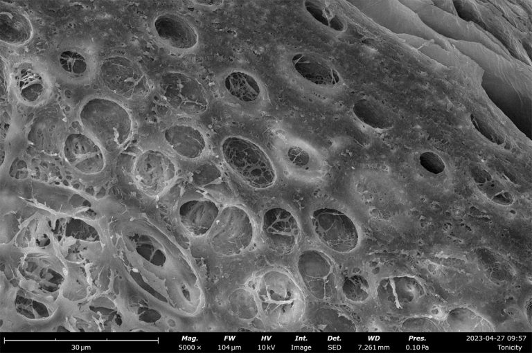 Visualizing Skin Tissue Morphology with Scanning Electron Microscopy ...