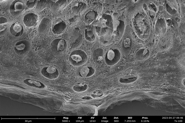 Visualizing Skin Tissue Morphology with Scanning Electron Microscopy ...