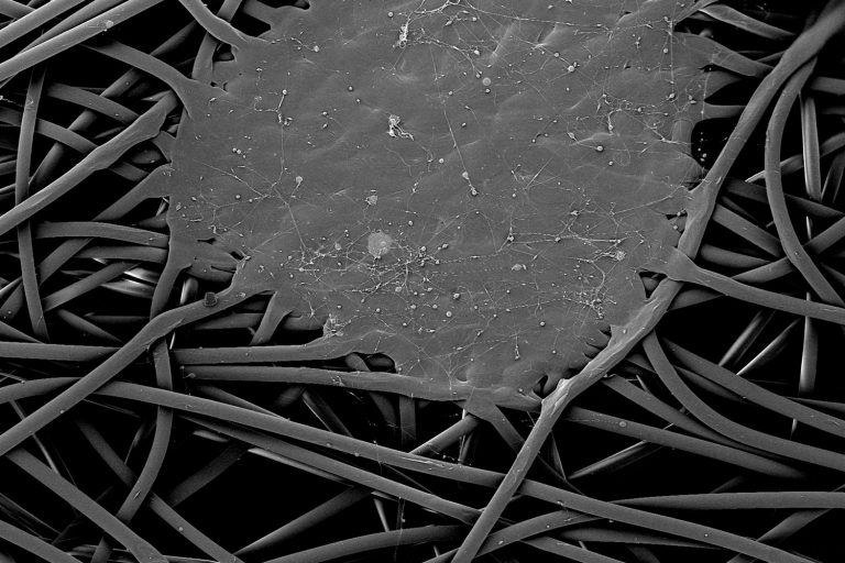 What Role Does SEM Play in Trace Evidence Analysis? | Nanoscience ...