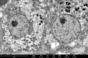 Scanning Transmission Electron Microscopy | Nanoscience Instruments