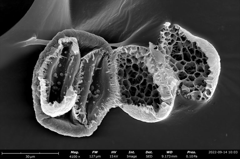 Struck by an Electron Beam: Interactions at the Surface in SEM ...