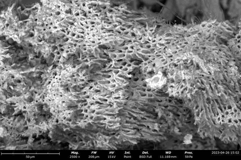 The Role of SEM in the Medical Device Industry | Nanoscience Instruments