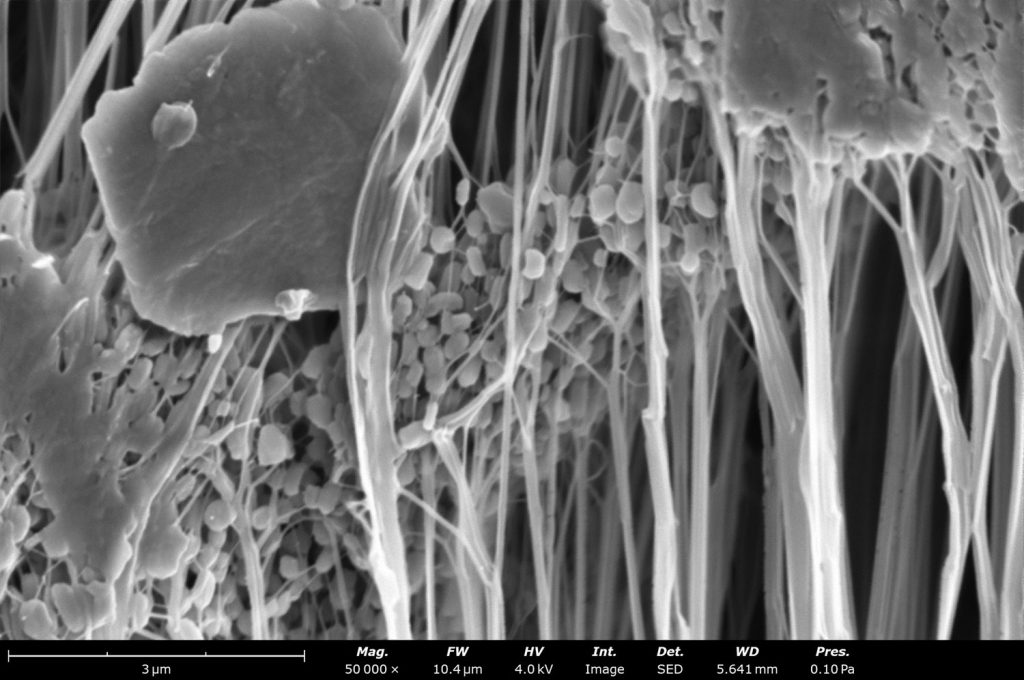 Thermionic vs. Field Emission Sources: 4 Key Differences | Nanoscience ...