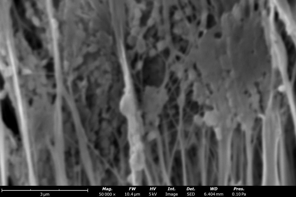 Thermionic vs. Field Emission Sources: 4 Key Differences | Nanoscience ...