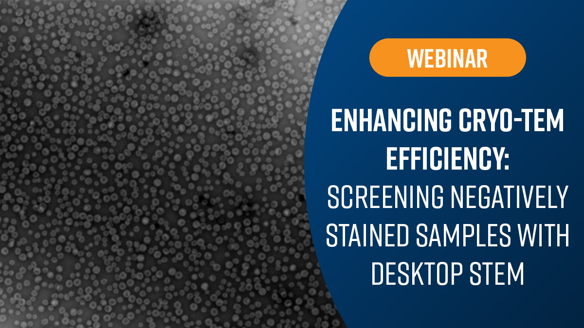 Enhancing Cryo-TEM Efficiency: Screening Negatively Stained Samples ...