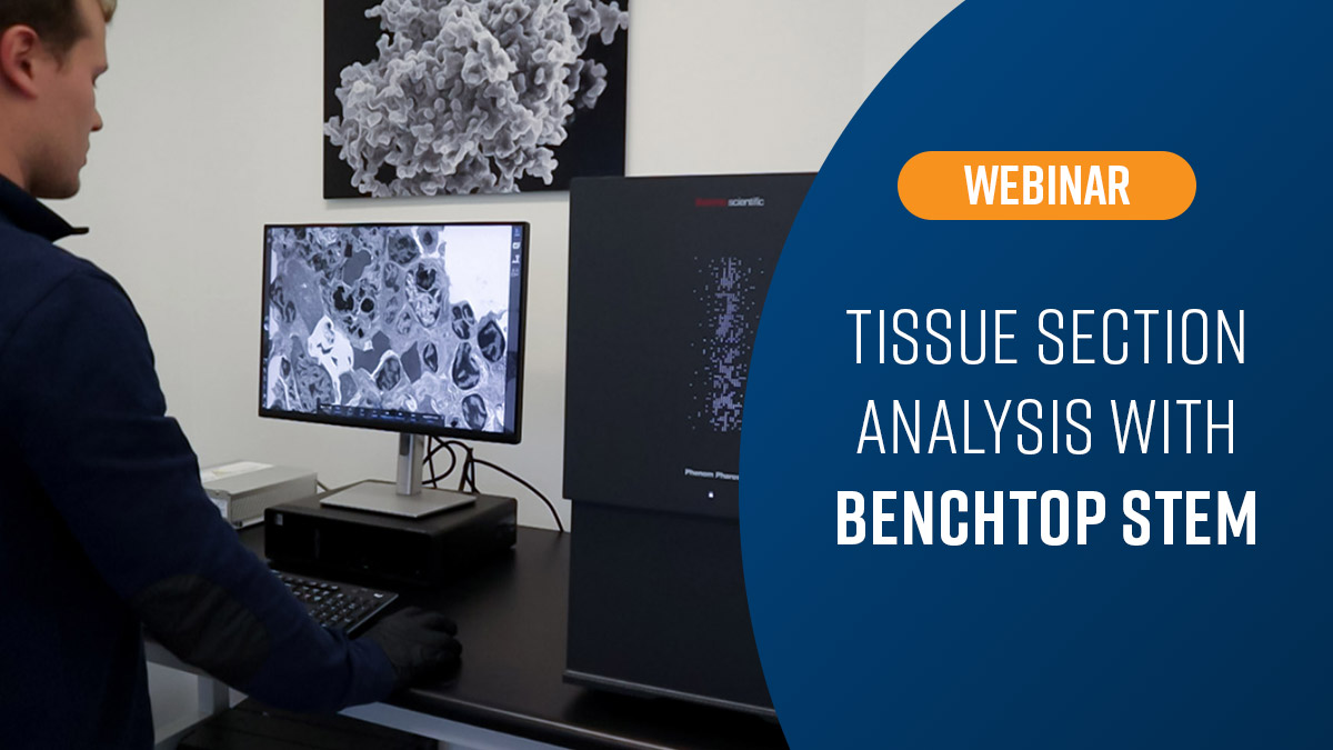 Tissue Section Analysis with Benchtop STEM | Nanoscience Instruments