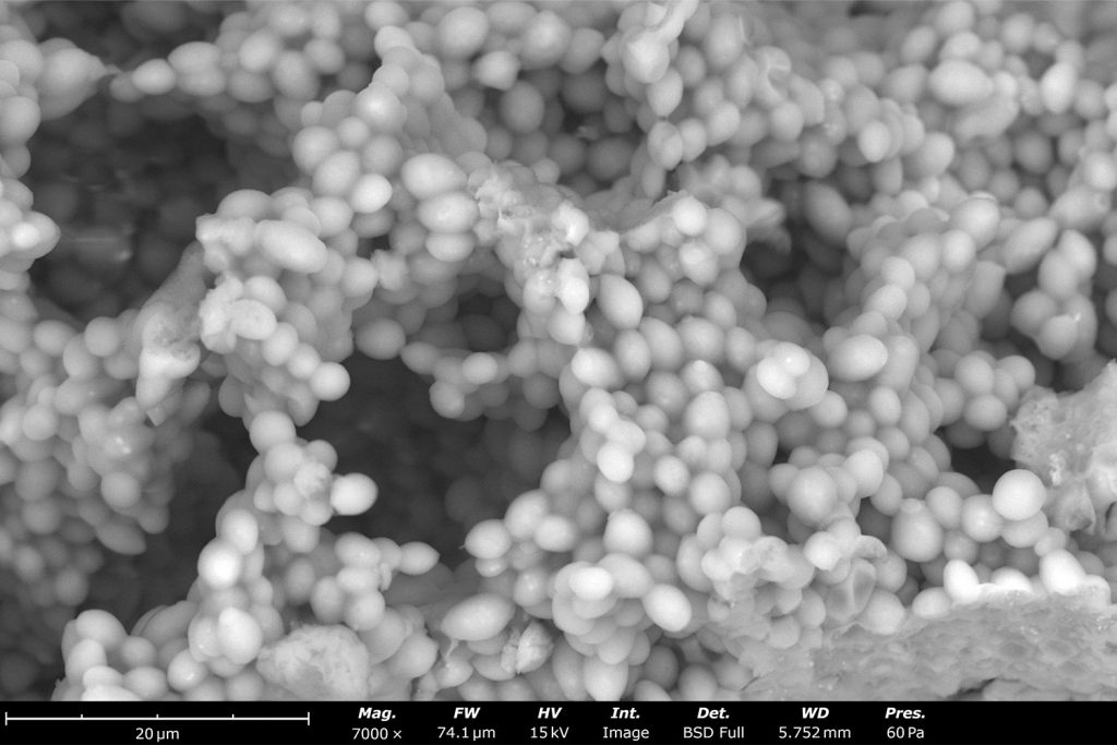 Automated SEM: The Future of Particle Analysis | Nanoscience Instruments
