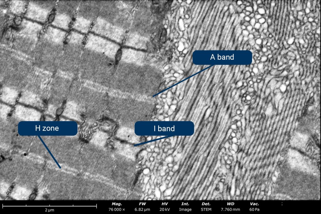 Benchtop STEM-in-SEM: A Powerful Tool for Tissue Ultrastructure Studies ...